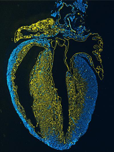 A Surprising Route to the Heart's Vessels (2 | EurekAlert!