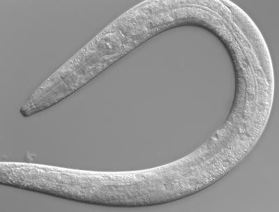 Sleep-Deprived Worms [IMAGE] | EurekAlert! Science News Releases
