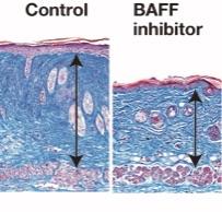 BAFF Inhibition [IMAGE] | EurekAlert! Science News Releases