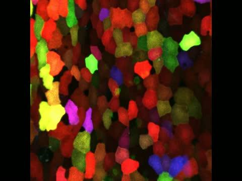 Skin regeneration in technicolor | EurekAlert!