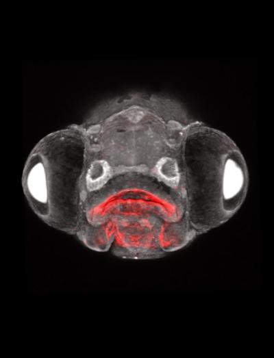 Larval Zebrafish Face [IMAGE] | EurekAlert! Science News Releases