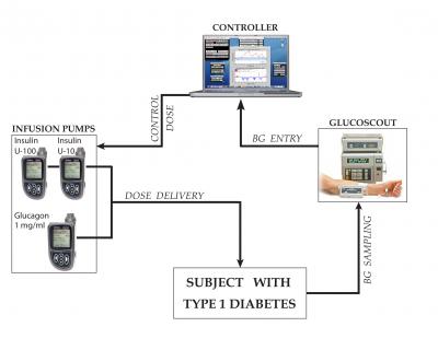 Controlling Diabetes: Meet Your Artificial Pa | EurekAlert!