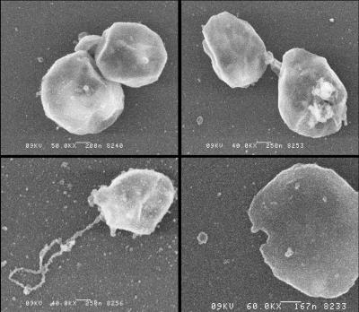 Dehalococcoides [IMAGE] | EurekAlert! Science News Releases