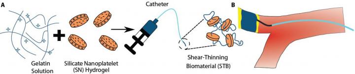 Gel Plugs Blood Vessels to Stem Bleeding (1 o | EurekAlert!