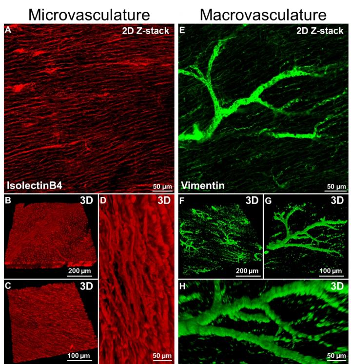 Transparent Heart Tissue Revea [IMAGE] | EurekAlert! Science News Releases