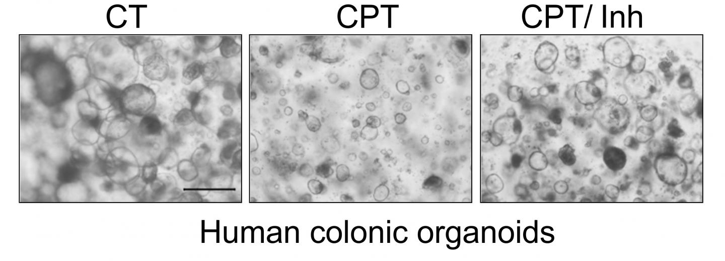 Protecting the Intestines from the Ravages of | EurekAlert!