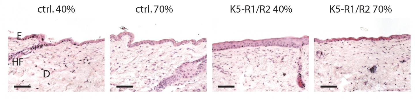 How High Humidity Levels Help Skin Ailments ( | EurekAlert!