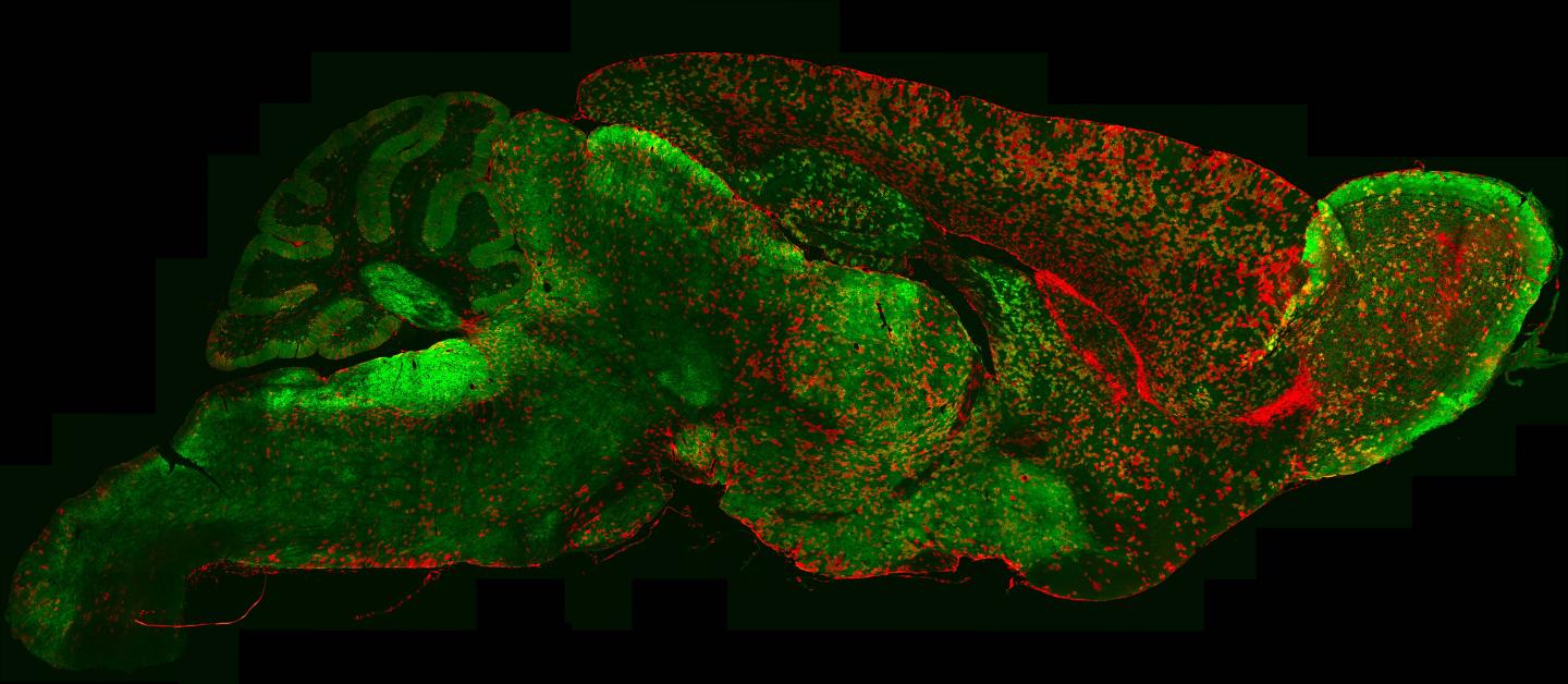 Microscope Image Showing Astro [IMAGE] | EurekAlert! Science News Releases
