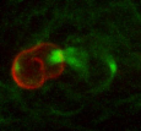 Asymmetric Central Spindle [IMAGE] | EurekAlert! Science News Releases