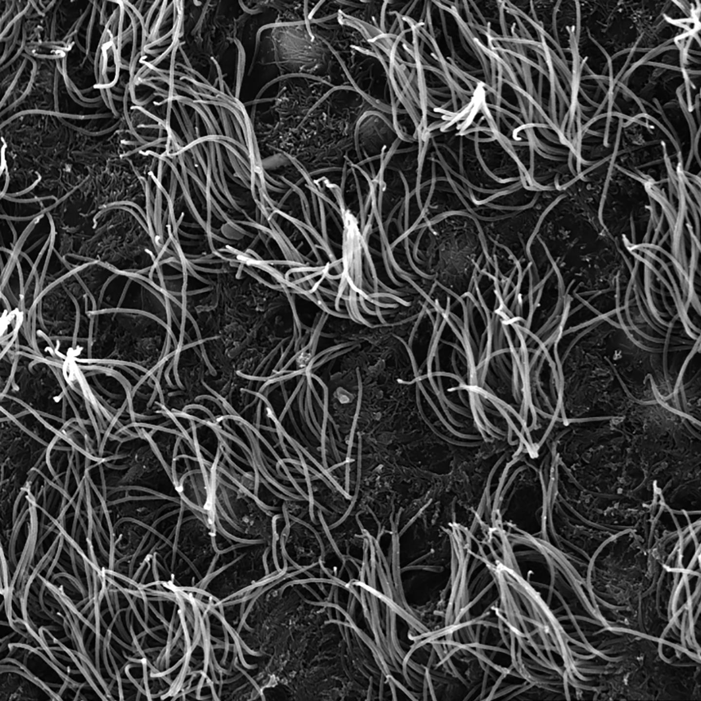 Ependymal Cells [IMAGE] | EurekAlert! Science News Releases