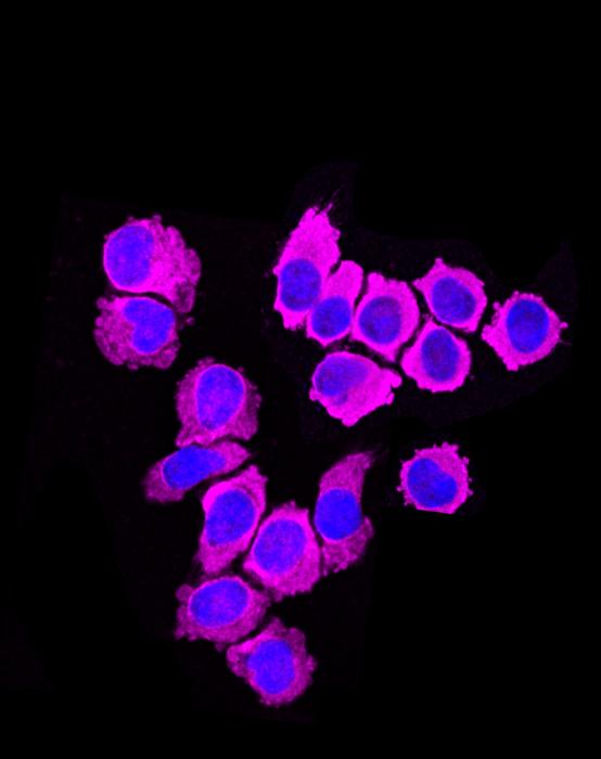 ILC2 cells [IMAGE] | EurekAlert! Science News Releases