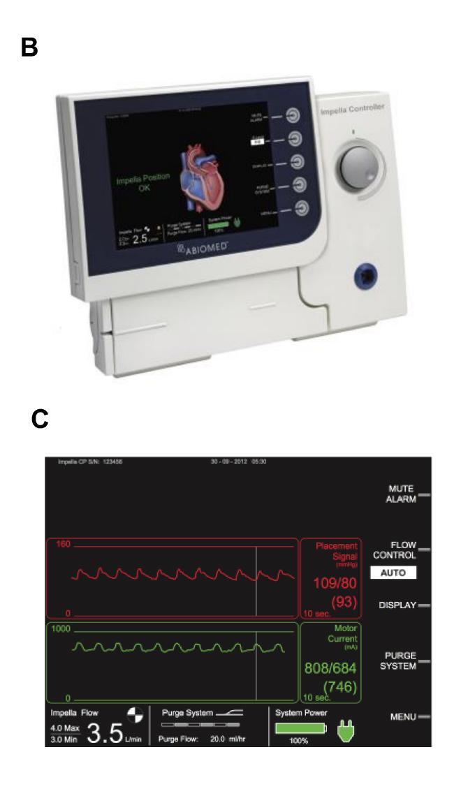 Implantable Machines Measure Heart Function ( | EurekAlert!