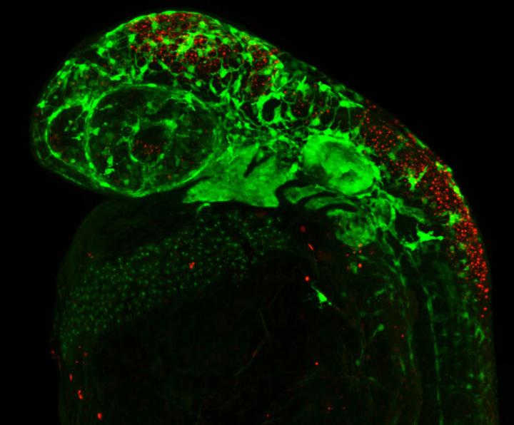 Cell Death [IMAGE] | EurekAlert! Science News Releases