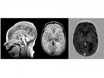 Meat, egg and dairy nutrient essential for br | EurekAlert!