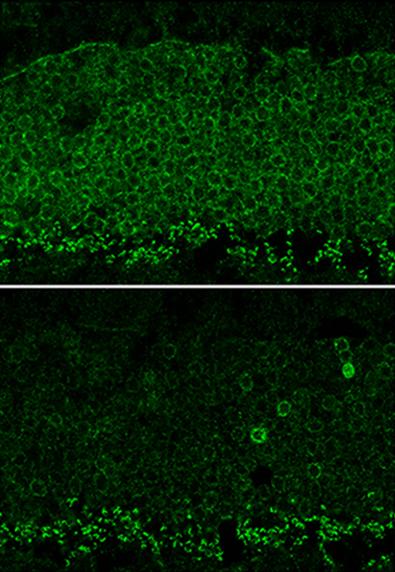 Nrl Gene Expression in Mouse R [IMAGE] | EurekAlert! Science News Releases