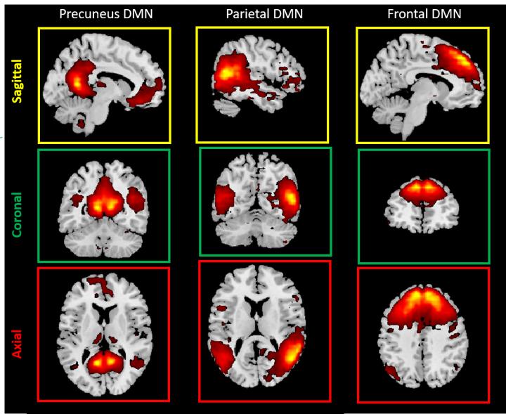Brain Images of Youth Football [IMAGE] | EurekAlert! Science News Releases