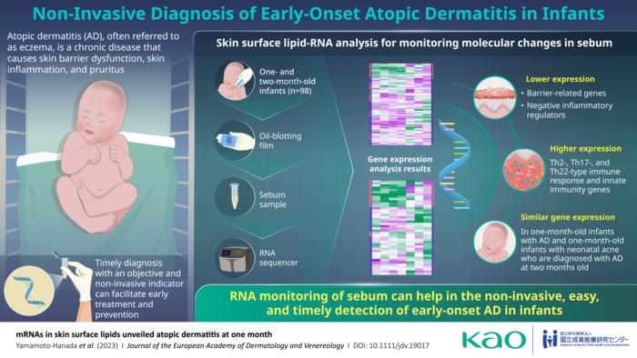 A novel way to diagnose early-onset atopic de | EurekAlert!