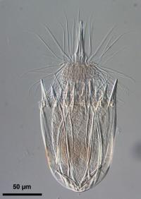 New species of elusive loriciferans described | EurekAlert!