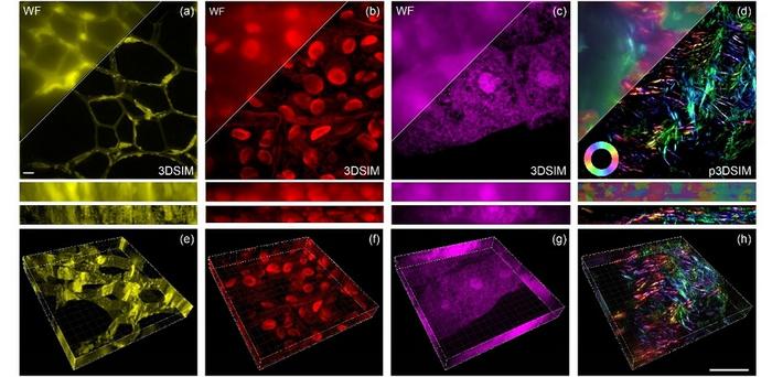 Super-resolution microscopy harnesses digital | EurekAlert!