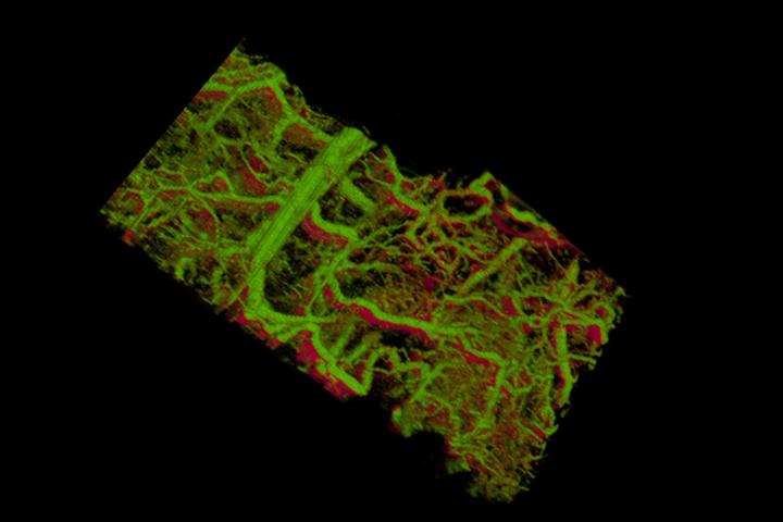 Blood Vessels in the Ear of a [IMAGE] | EurekAlert! Science News Releases