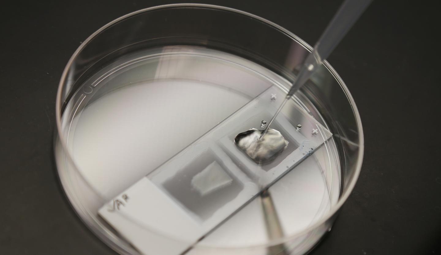 Expansion Microscopy [IMAGE] | EurekAlert! Science News Releases