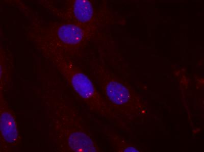 Toxic RNA [IMAGE] | EurekAlert! Science News Releases