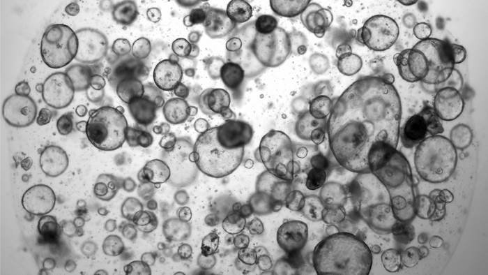 Pancreatic Cancer Organoids [IMAGE] | EurekAlert! Science News Releases