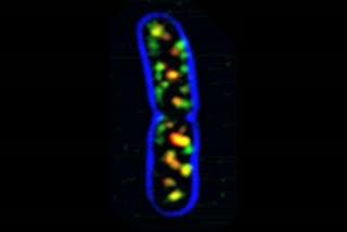New View of Elongating Bacteria (4 of 5) | EurekAlert!