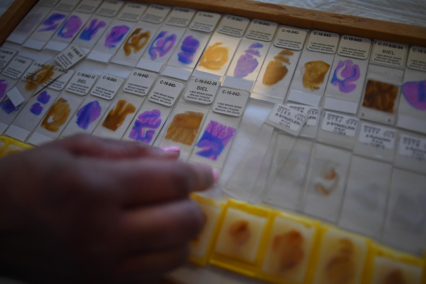 McLean's Brain Bank Receives N [IMAGE] | EurekAlert! Science News Releases