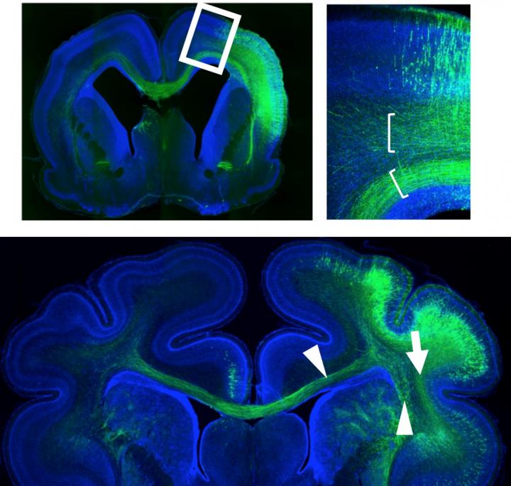 Map of neuronal pathways of the mammalian cer | EurekAlert!