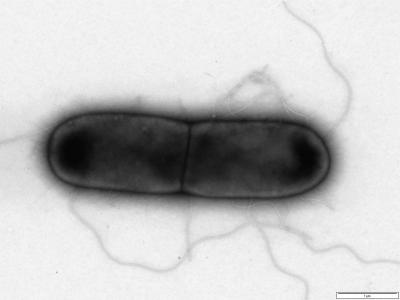 Clostridium difficile C [IMAGE] | EurekAlert! Science News Releases