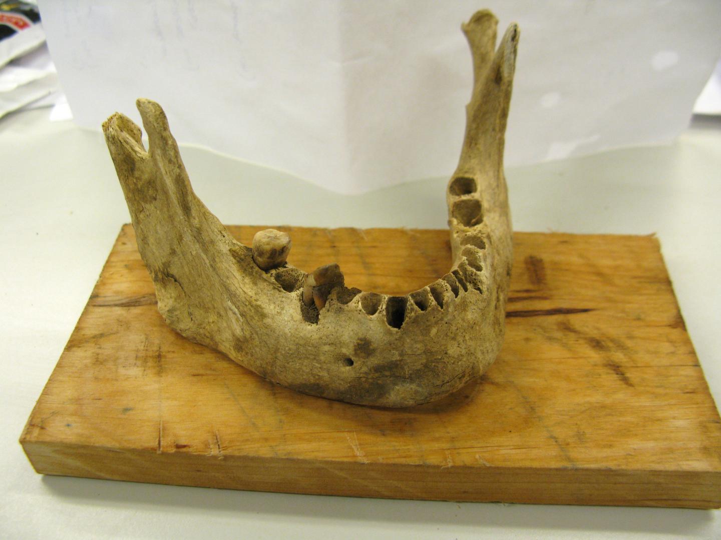 The Teeth of the Deceased [IMAGE] | EurekAlert! Science News Releases