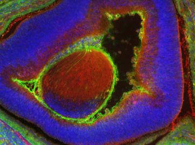 Human eye cells in a mouse emb [IMAGE] | EurekAlert! Science News Releases