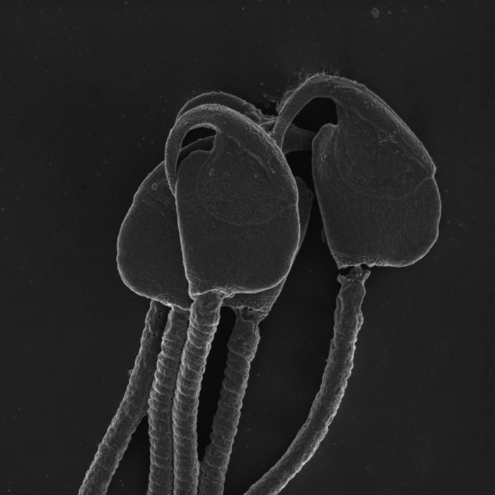 SEM clump head [IMAGE] | EurekAlert! Science News Releases