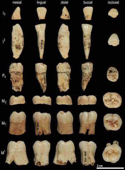 Homo antecessor teeth [IMAGE] | EurekAlert! Science News Releases