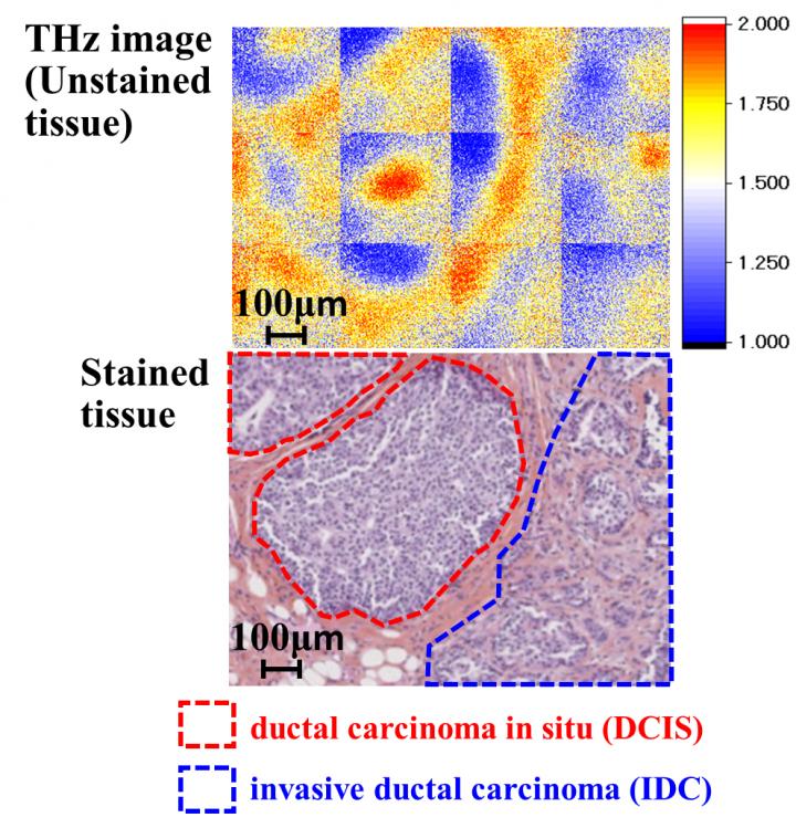 Unstained Tissue [IMAGE] | EurekAlert! Science News Releases