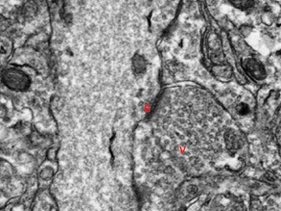 Mouse Brain Tissue [IMAGE] | EurekAlert! Science News Releases