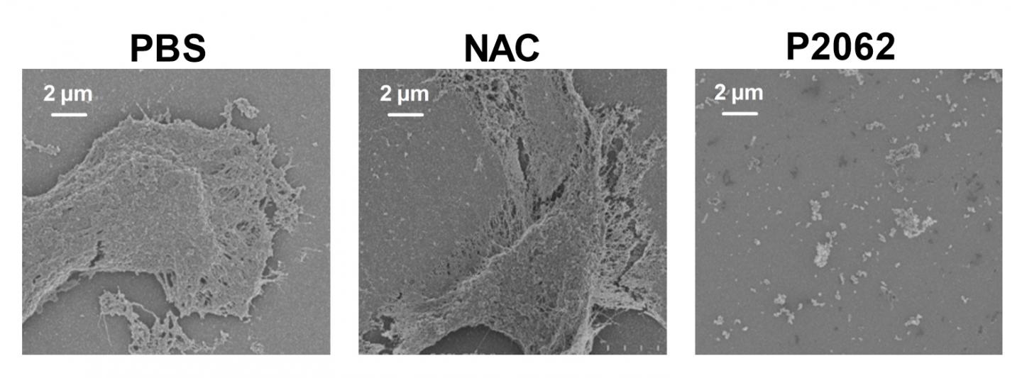 mucus-accumulation-precedes-dangerous-lung-in-eurekalert