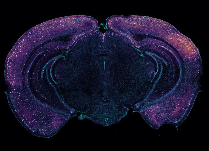 VIP neurons [IMAGE] | EurekAlert! Science News Releases