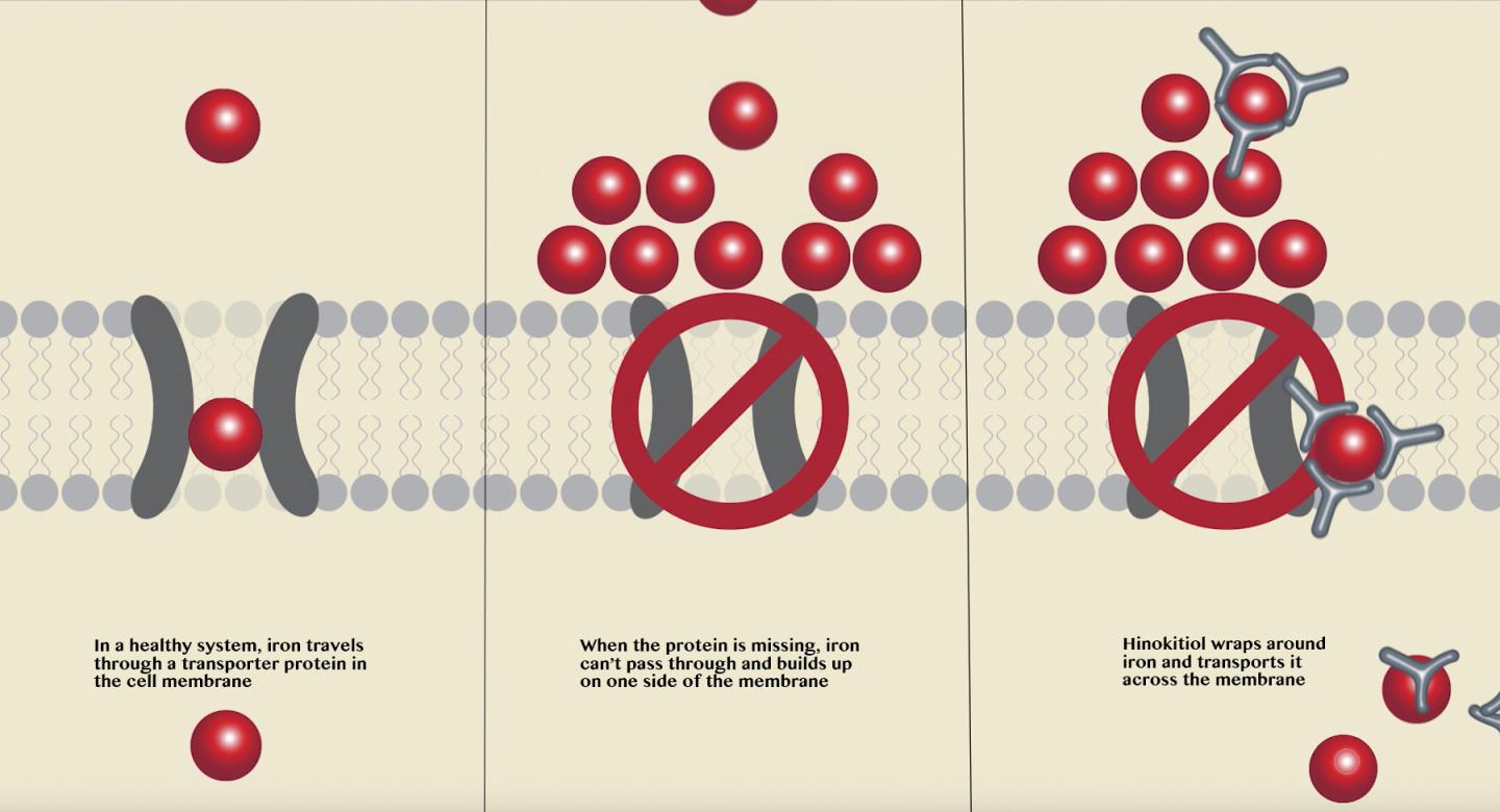 When Iron Transport Is Defecti [IMAGE] | EurekAlert! Science News Releases