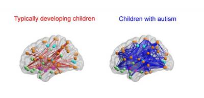 Social symptoms in autistic children may be c | EurekAlert!