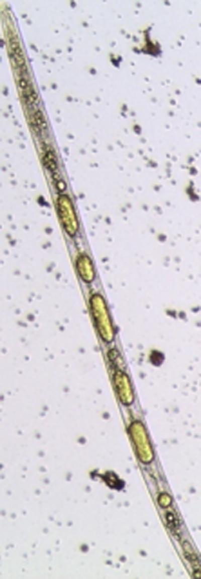 Nematode [IMAGE] | EurekAlert! Science News Releases