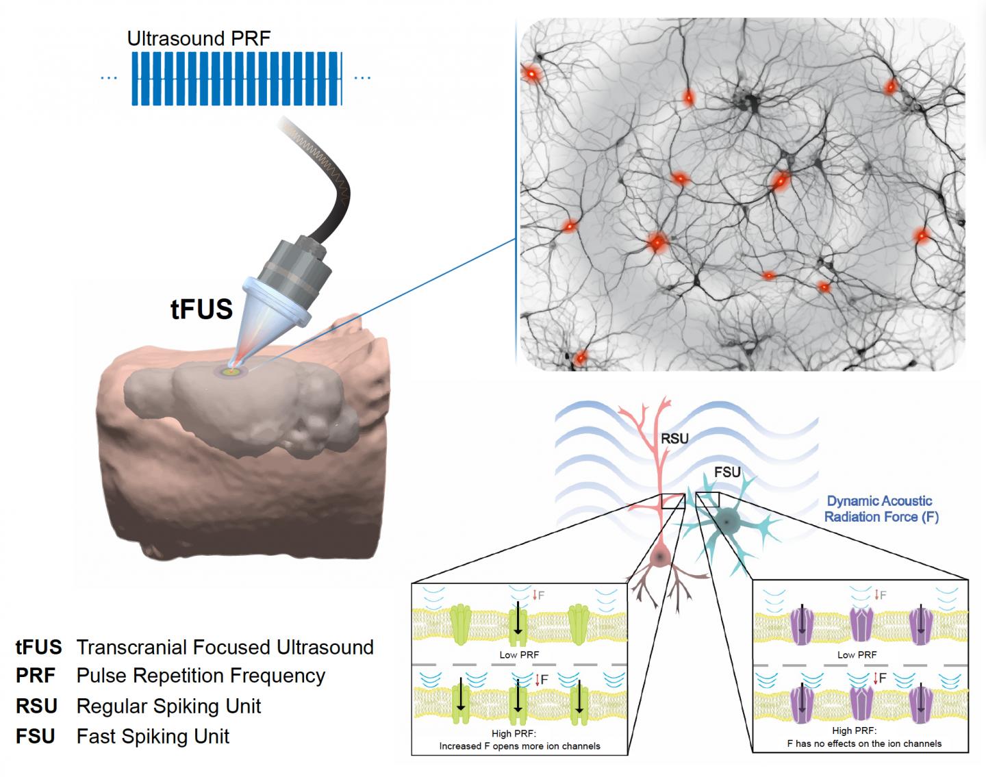 tFUS Study Concept [IMAGE] | EurekAlert! Science News Releases