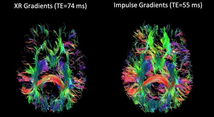 NexGen 7T brain scanner allows [IMAGE] | EurekAlert! Science News Releases