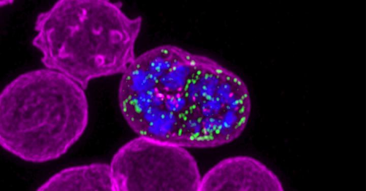 Malaria in Red Blood Cells [IMAGE] | EurekAlert! Science News Releases