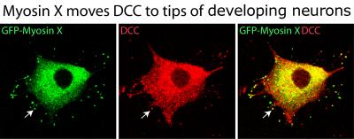 Myosin X [IMAGE] | EurekAlert! Science News Releases