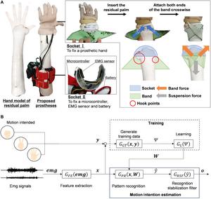 Development of wrist separated exoskeleton so | EurekAlert!