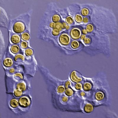 Cryptococcus gatti [IMAGE] | EurekAlert! Science News Releases