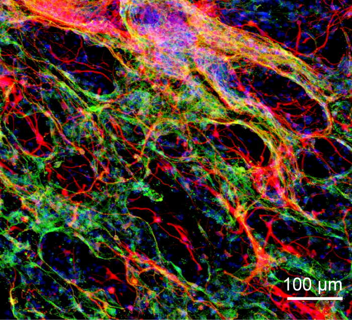 Immunofluorescence image of ne [IMAGE] | EurekAlert! Science News Releases