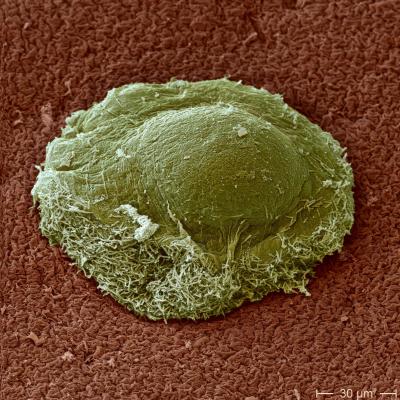 Myxococcus xanthus Fruiting Bo [IMAGE] | EurekAlert! Science News Releases